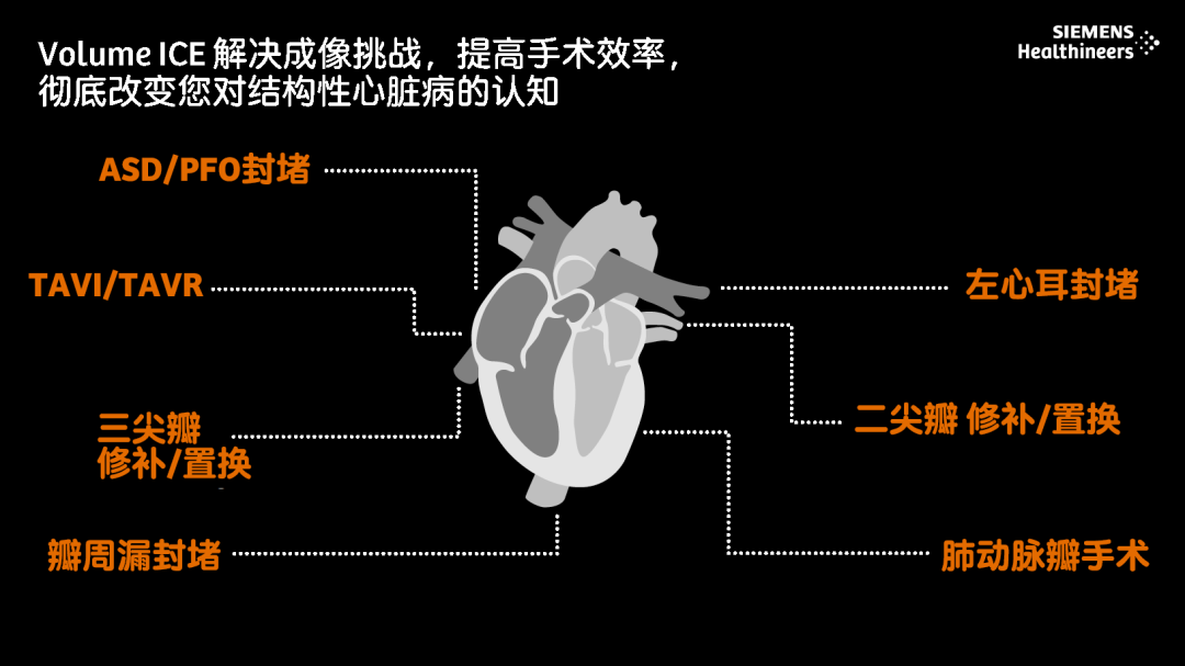 凯乘行研：心腔内超声（ICE）-MedSci.cn