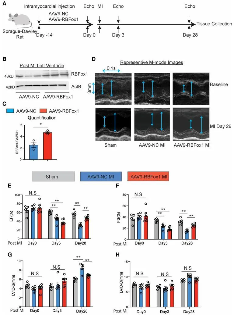 Cardiovasc Res 高晨/王义斌/胡新央团队合作揭示RNA结合蛋白RBFox1在心梗造成的心衰中的作用及机制-MedSci.cn