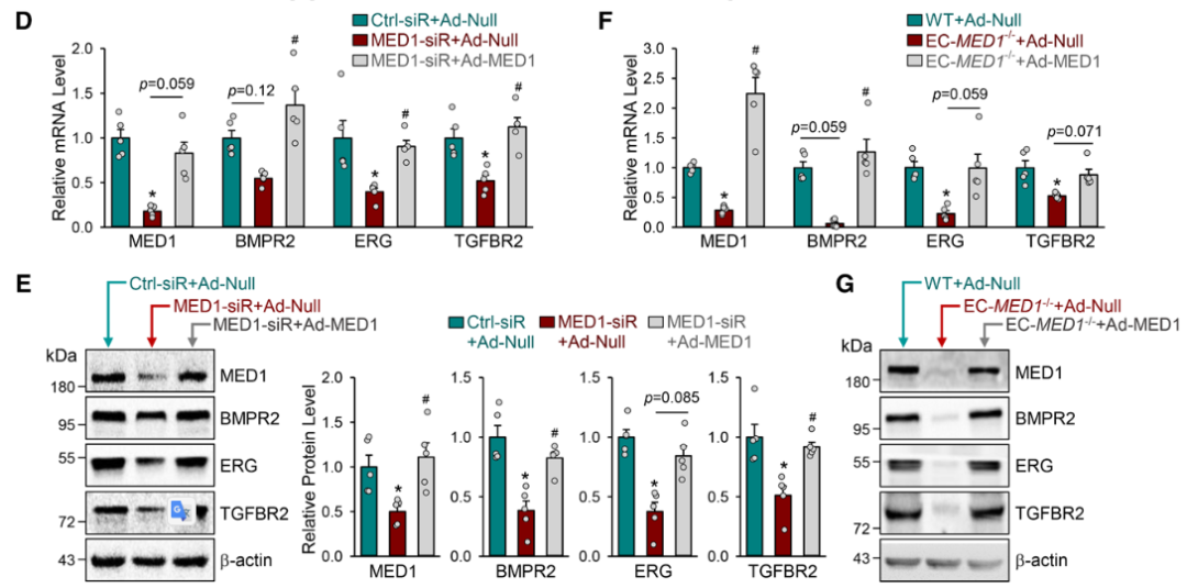 关于MED1调控内皮细胞的BMP/TGF-β对肺动脉高血压影响的新发现！-MedSci.cn