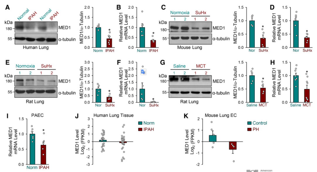 关于MED1调控内皮细胞的BMP/TGF-β对肺动脉高血压影响的新发现！-MedSci.cn
